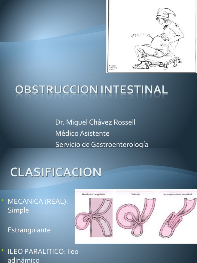 Obstruccion Intestinal | PDF | Estreñimiento | Gastroenterología