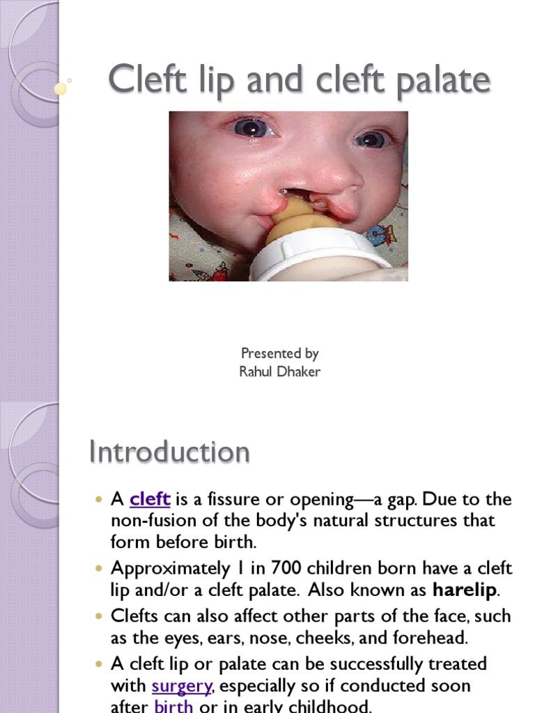 Cleft Lip and Palate | PDF | Primate Anatomy | Facial Features