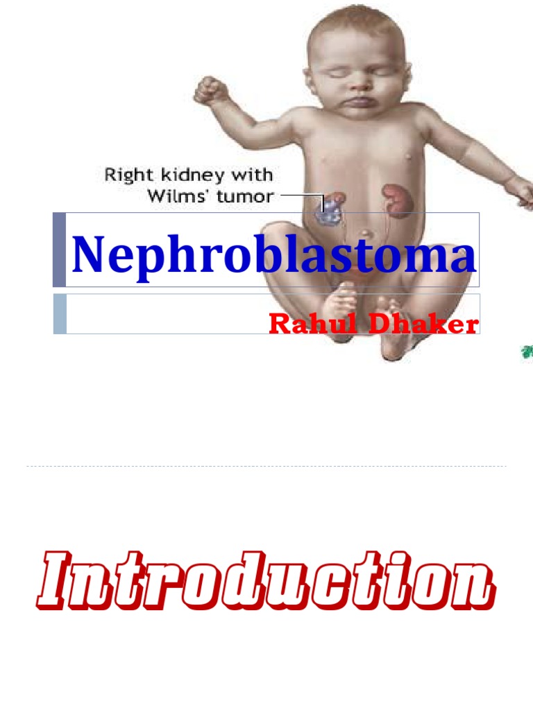 Nephroblastoma: Rahul Dhaker | PDF | Radiation Therapy | Metastasis