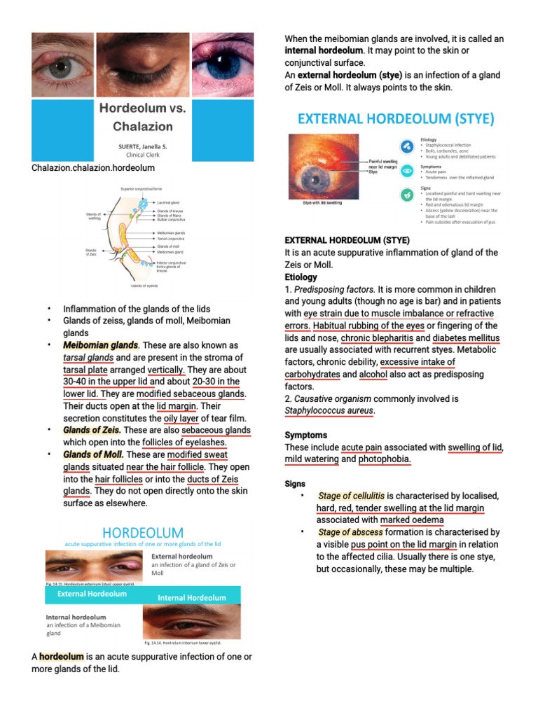 Internal Hordeolum. It May Point To The Skin or External Hordeolum ...