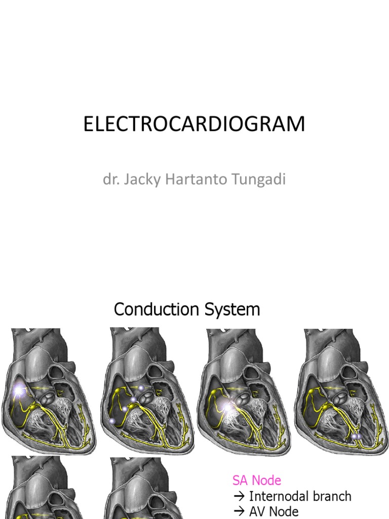 Cardio INTERPRETATION OF THE ELECTROCARDIOGRAM | PDF ...