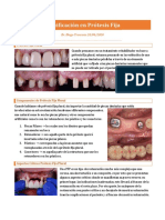 Linea de Fulcrum | PDF