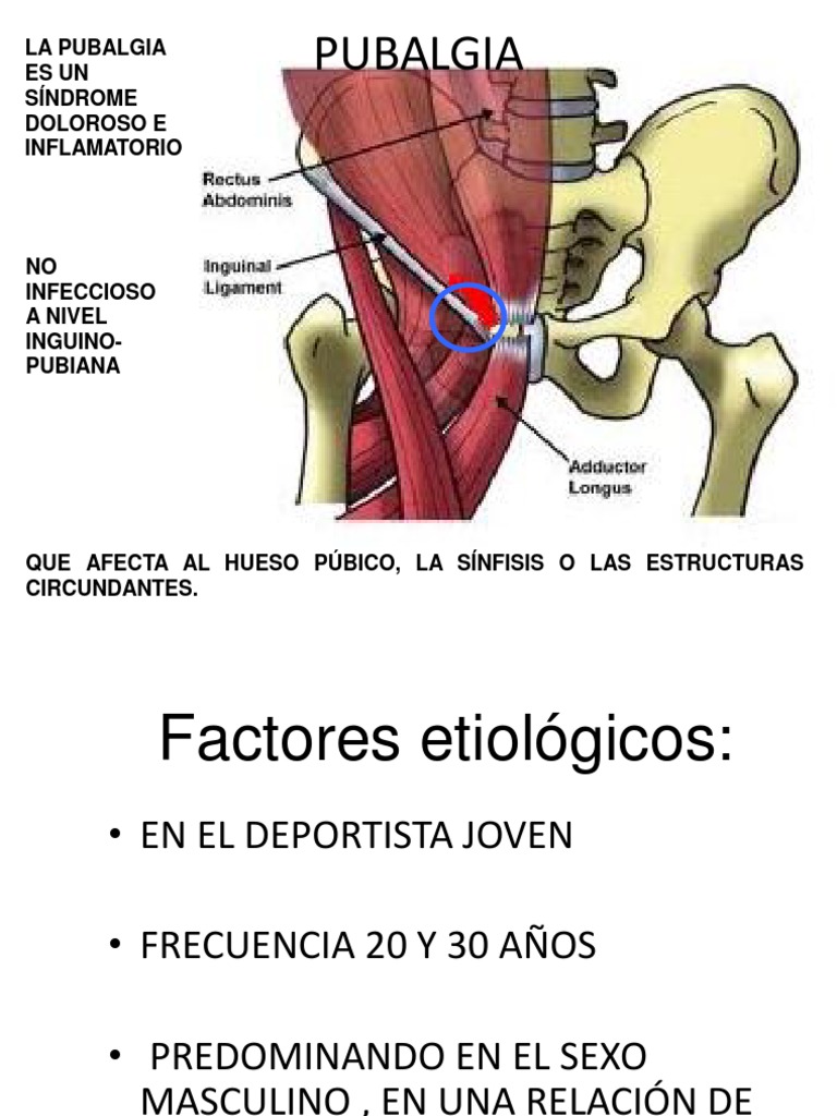 19 Pubalgia PDF | PDF | Terapia física | Enfermedades y trastornos