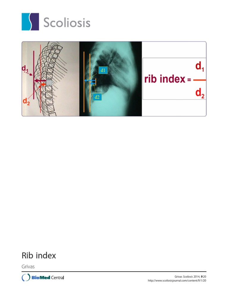 Rib Index | PDF | Scoliosis | Vertebral Column