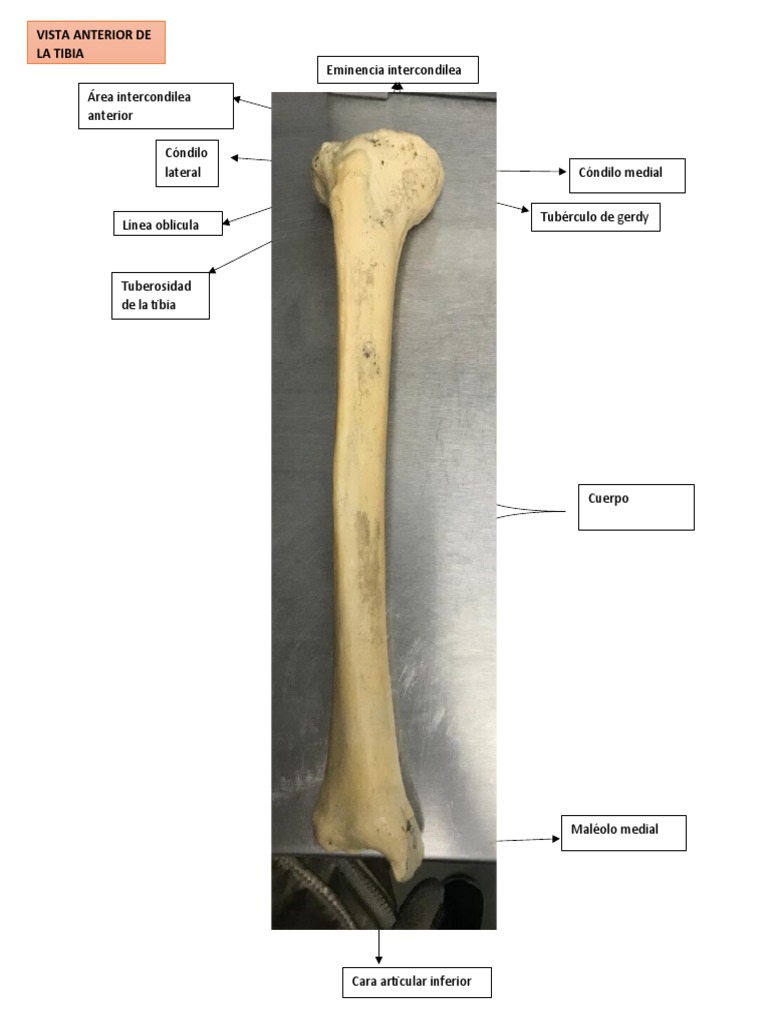Eminencia Intercondílea Tibial