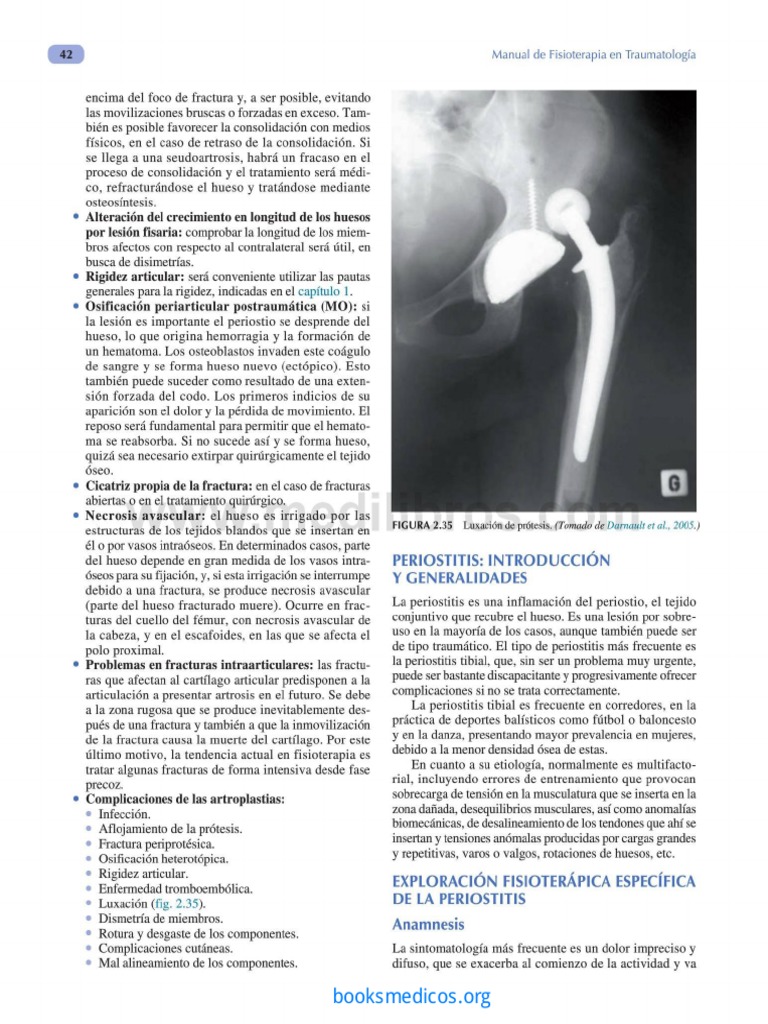 Periostitis | PDF | Hueso | Rodilla