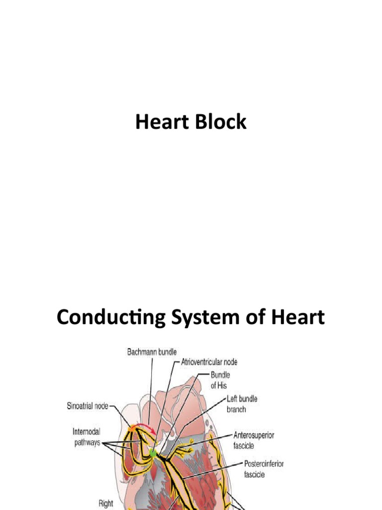 Heart Block | Download Free PDF | Cardiac Electrophysiology | Cardiology