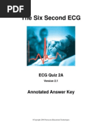 ICU One Pager External Pacemakers v11 | PDF | Artificial Cardiac ...