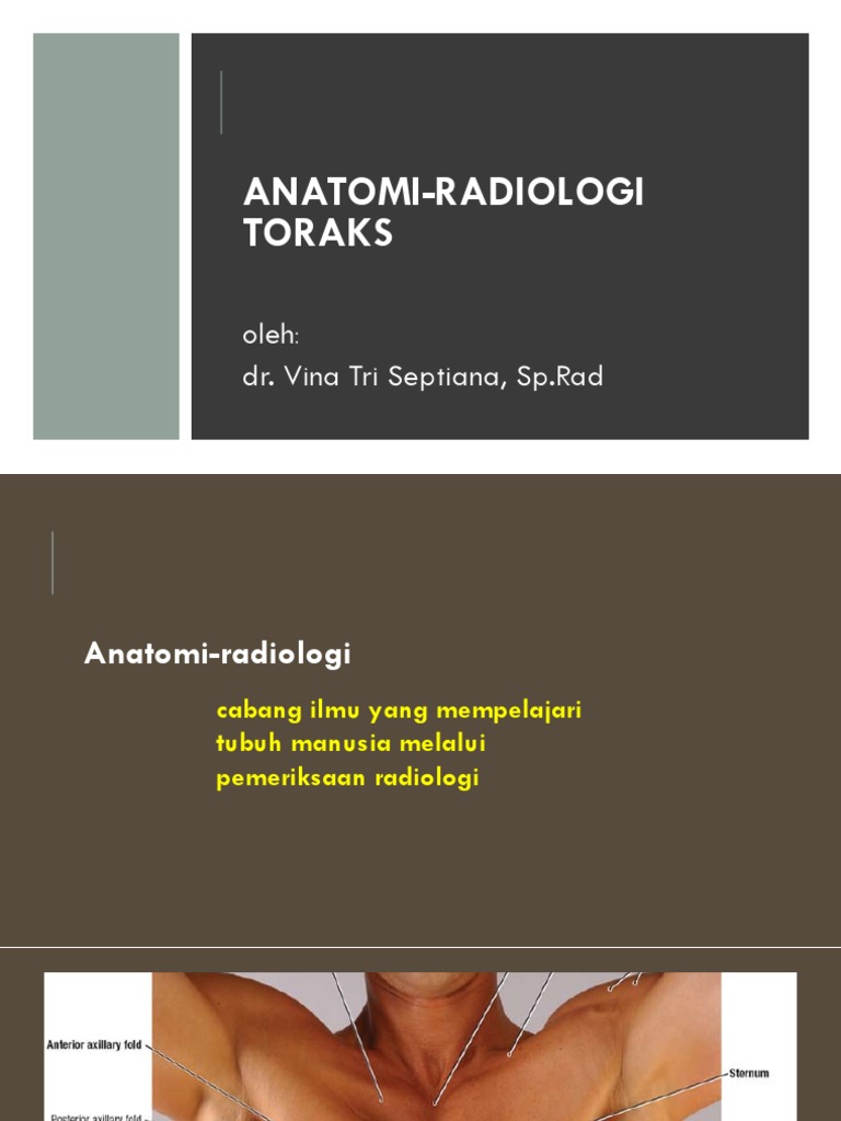 Kul Atro Radio-Anatomi Toraks | PDF