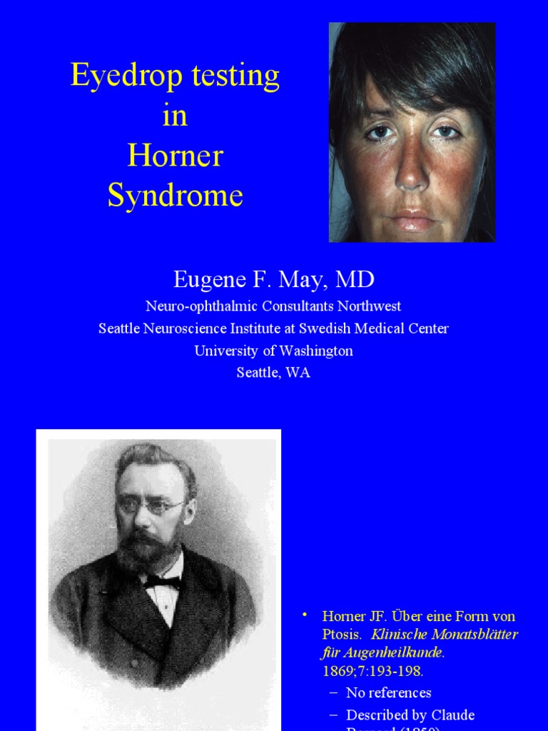 Eyedrop Testing in Horner Syndrome: Eugene F. May, MD | PDF | Clinical ...