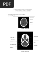 Judet View for Post-Prosthesis Patients | PDF