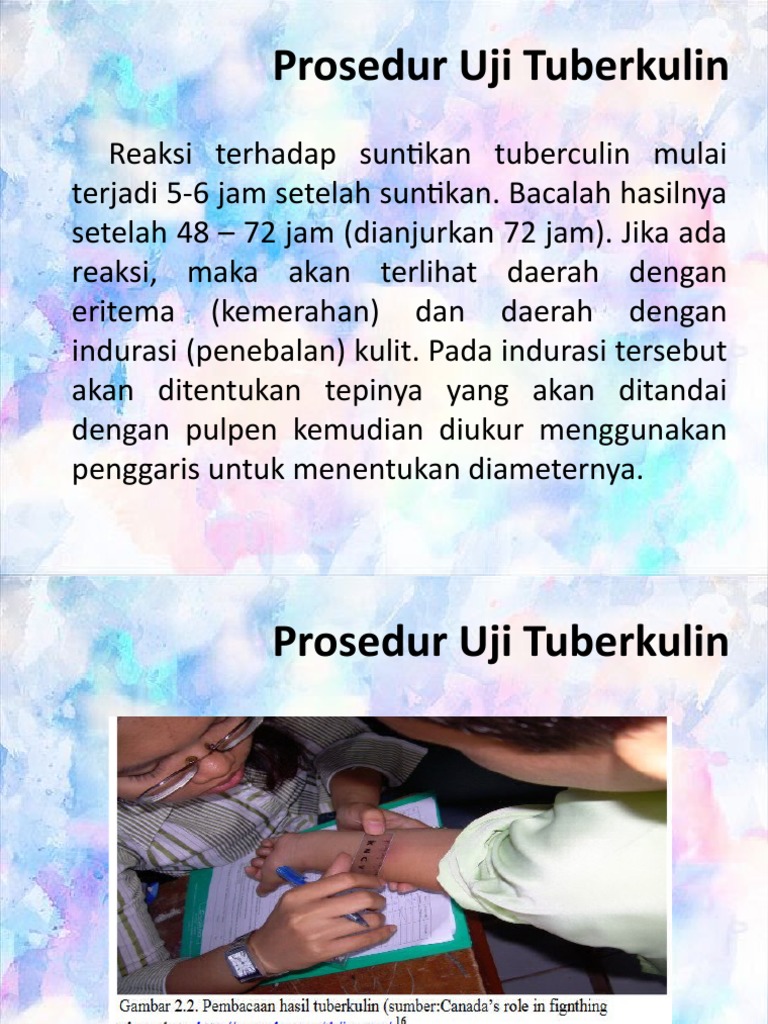 Prosedur Uji Tuberkulin | PDF | Pengembangan Diri