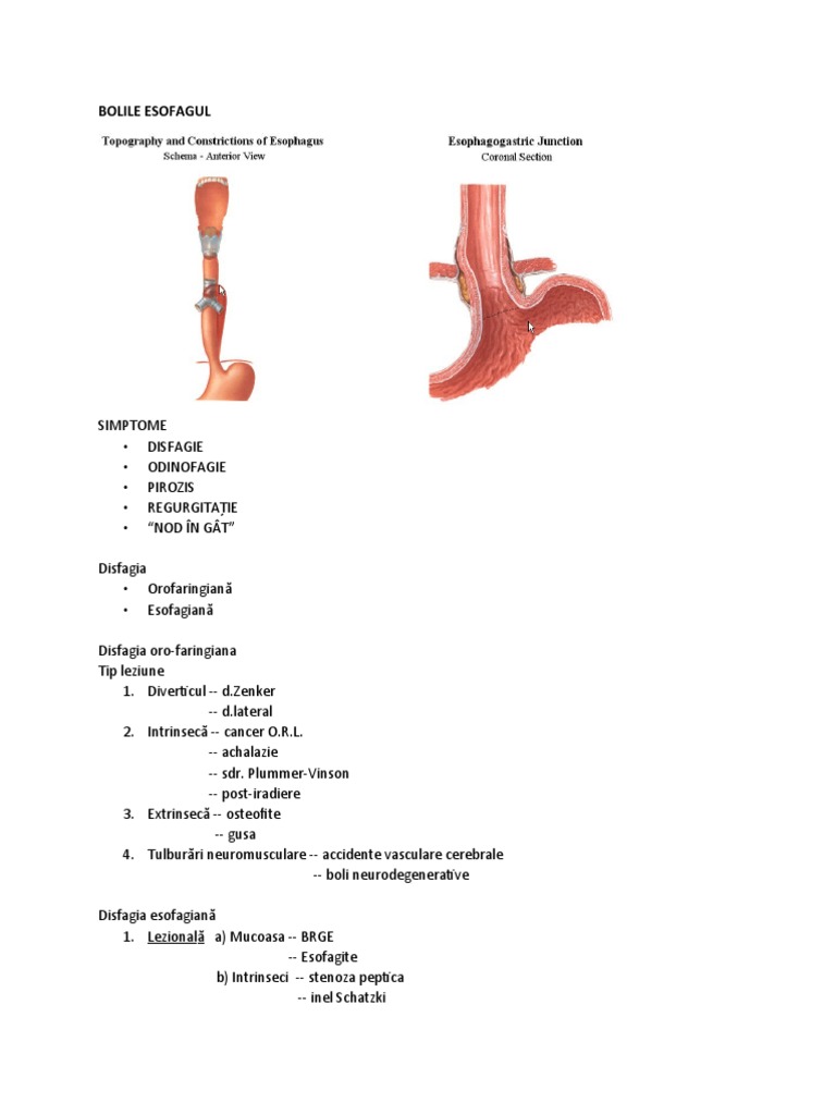 BOLILE ESOFAGUL Mia Tare | PDF | Esophagus | Gastroenterology