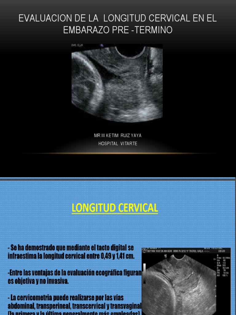 Evaluacion de La Longitud Cervical en El Embarazo Mr3 Ketim Ruiz Yaya | PDF