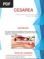 Tipos de Incisiones en Cesárea | PDF | Parto | El embarazo