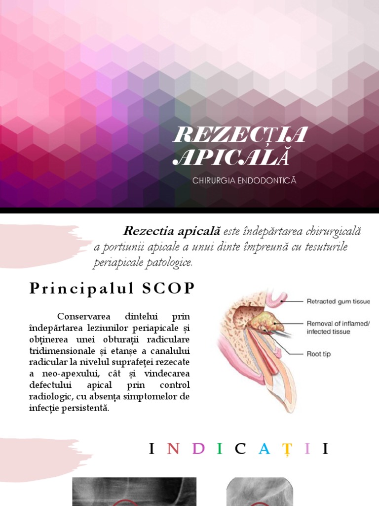 Rezecția Apicală LP 2019 - 2020 | PDF