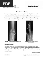 K-Wire Removal: Patient Guide | PDF | Patient | Medicine