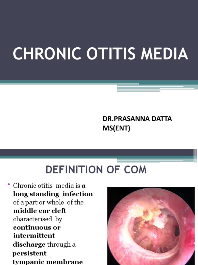 Chronic Otitis Media Types, Investigations, Treatment | PDF | Ear ...