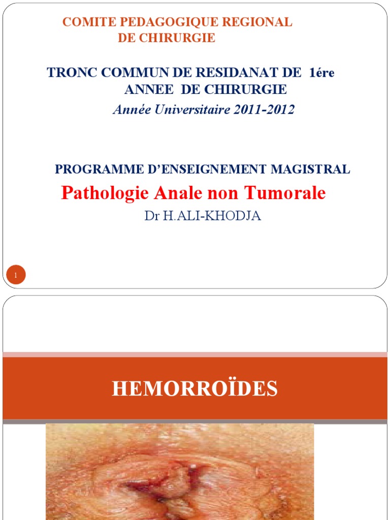 Hemorroides | PDF | Pathologie hémorroïdaire | Rectum
