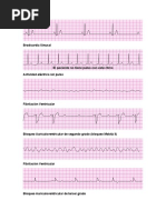 Pre-Evaluacion SVCA ACLS AHA 2015 Con Los Trazados Del EKG y Respuestas | PDF