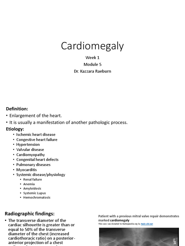 Cardiomegaly: Week 1 Dr. Kazzara Raeburn | PDF | Heart | Congenital ...