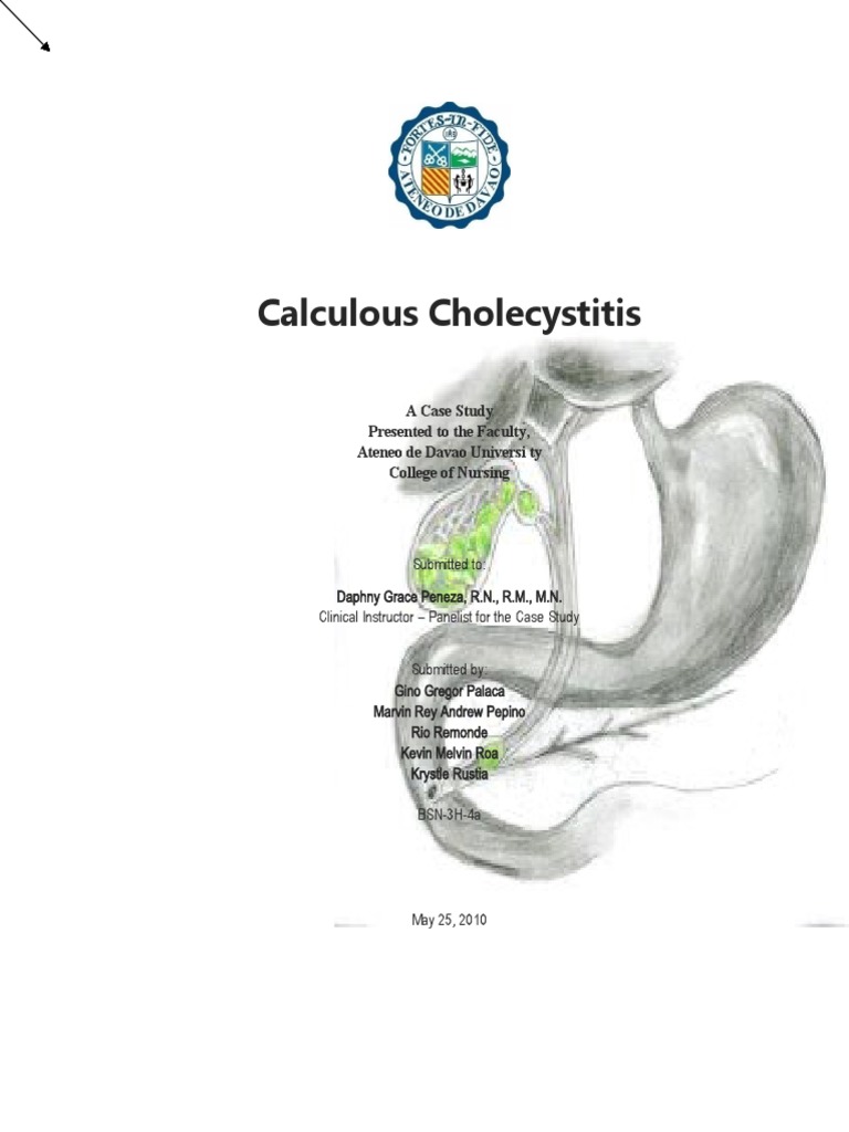 Calculous Cholecystitis | PDF | Medical Diagnosis | Gallbladder