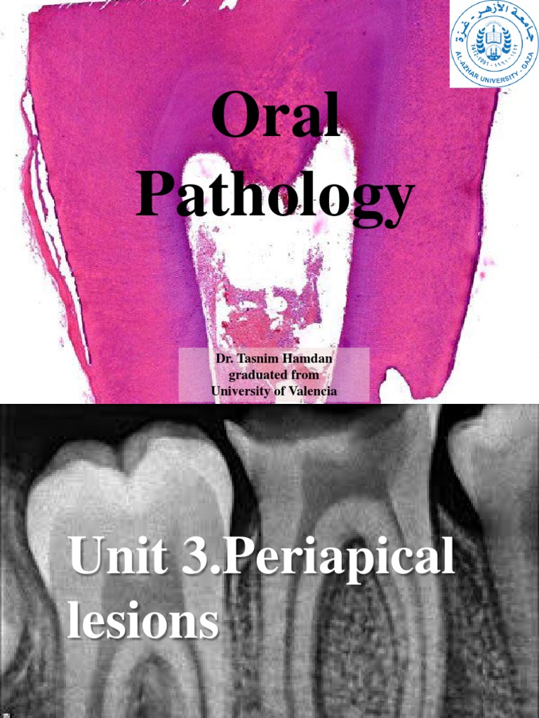 Oral Pathology: Dr. Tasnim Hamdan Graduated From University of Valencia ...