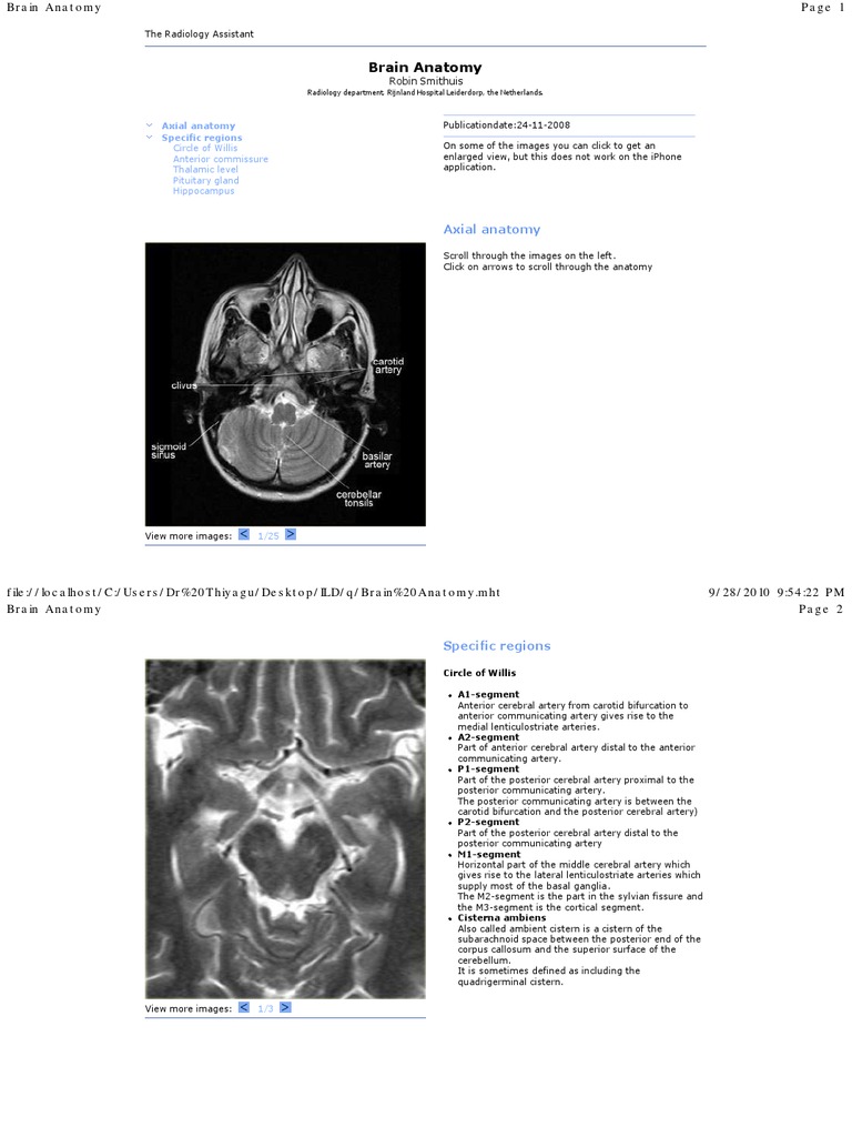 Brain Anatomy | PDF | Cerebrum | Human Brain