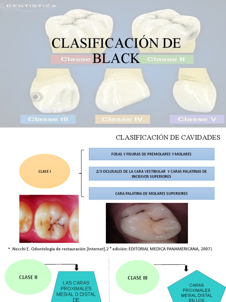 Clasificacion de Black | PDF
