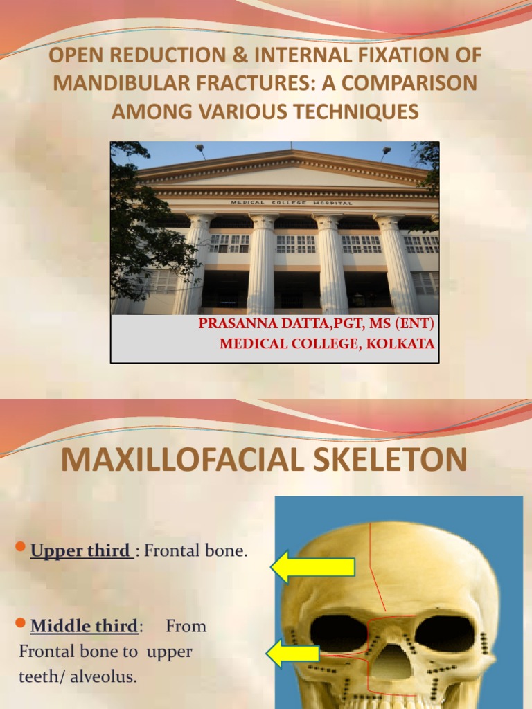Types & Management of Mandibular Fractures. | PDF | Surgical ...