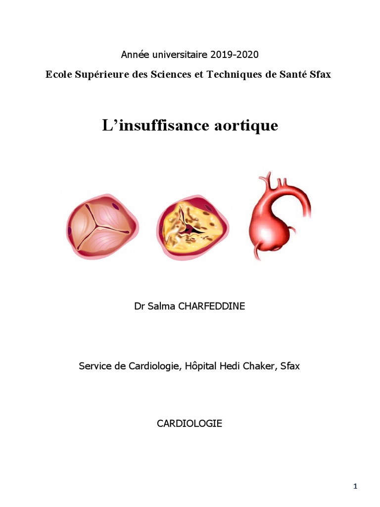 Insuffisance Aortique : Diagnostic et Traitement | PDF | Insuffisance ...