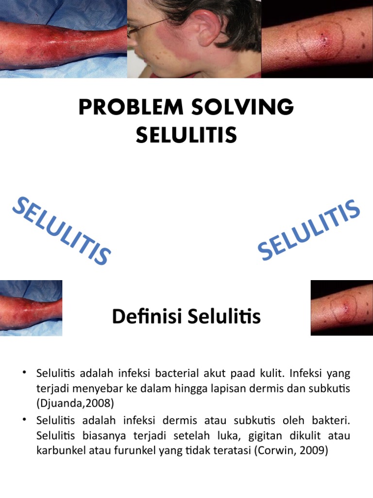 Fundamental Patofisiologi SELULITIS | PDF