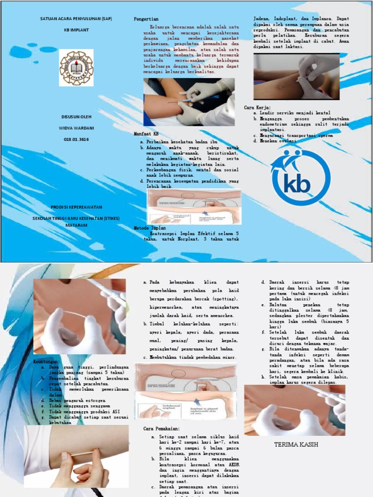 KB IMPLANT: METODE, MANFAAT DAN CARA KERJA | PDF