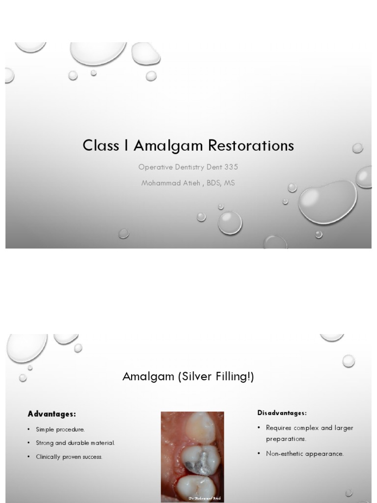Class I Amalgam Restorations: Operative Dentistry Dent 335 Mohammad ...