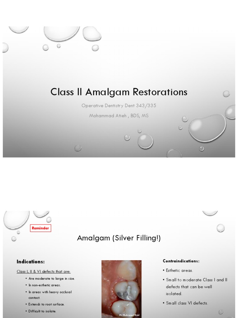 Class II Amalgam Restorations: Operative Dentistry Dent 343/335 ...