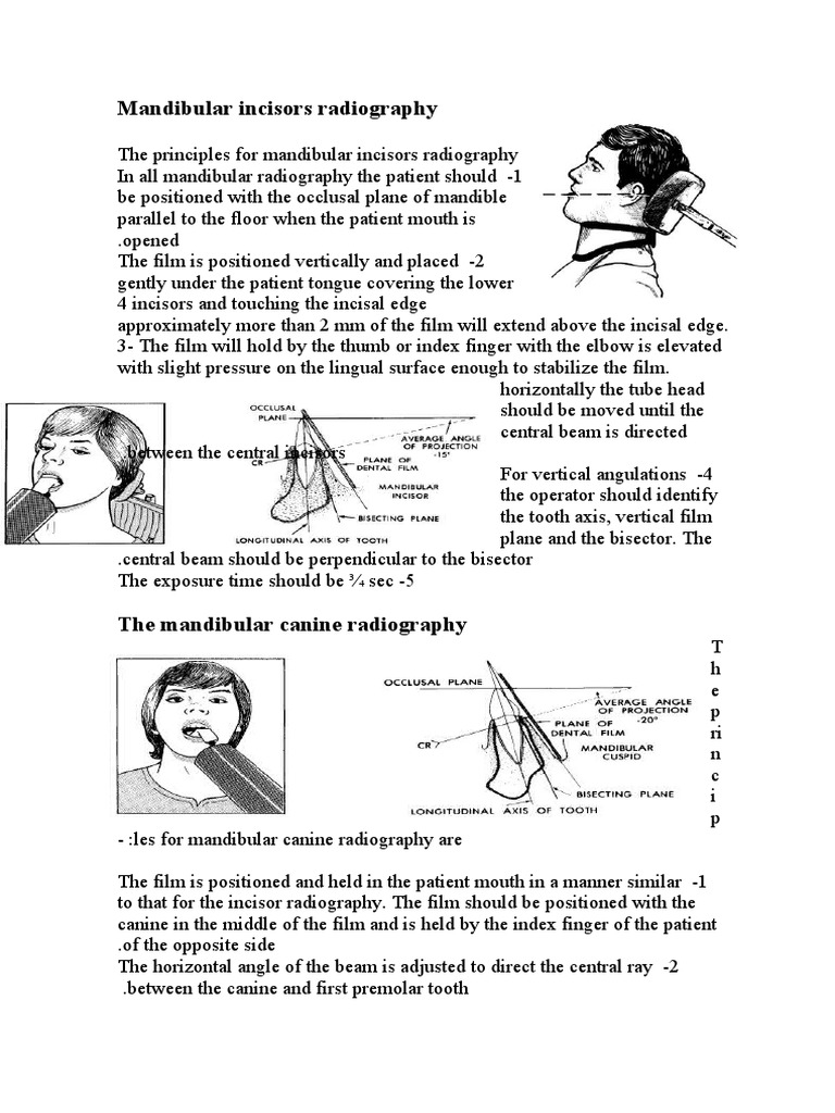 Mandibular Incisors Radiography | PDF | Mouth | Dentistry Branches