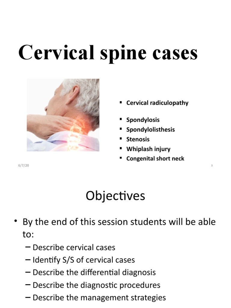 Cervical Spine Cases: Cervical Radiculopathy Spondylosis ...