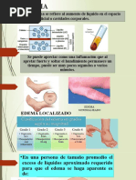 Sindrome Edematoso en Pediatria | PDF | Edema | Medicina CLINICA