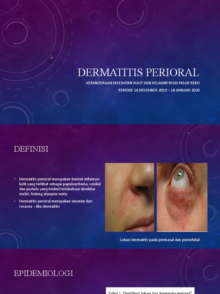 Dermatitis Perioral | PDF