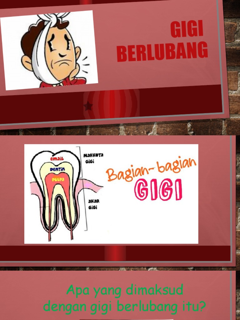 Penyuluhan Gigi Berlubang Karies | PDF