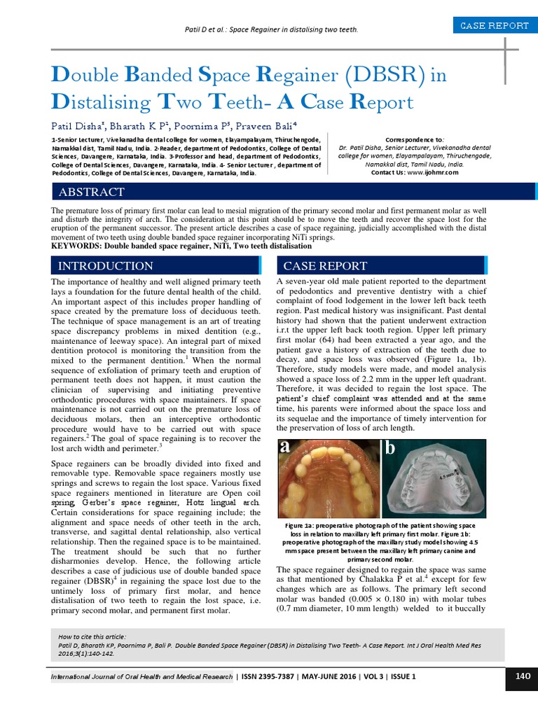 Double Banded Space Regainer (DBSR) in Distalising Two Teeth - A Case ...