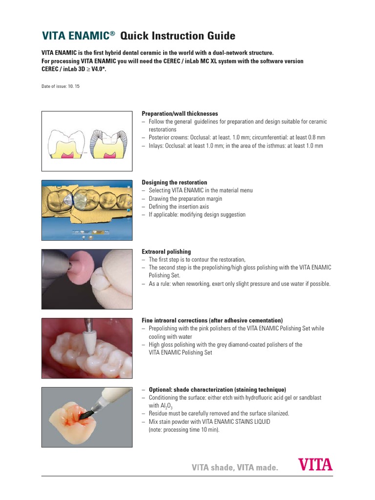 Vita Enamic: Quick Instruction Guide | PDF | Mouth | Dentistry Branches