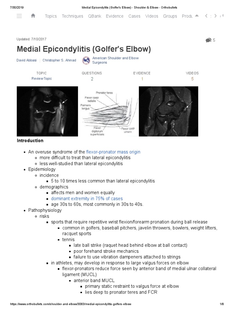 Medial Epicondylitis (Golfer's Elbow) - Shoulder & Elbow - Orthobullets ...