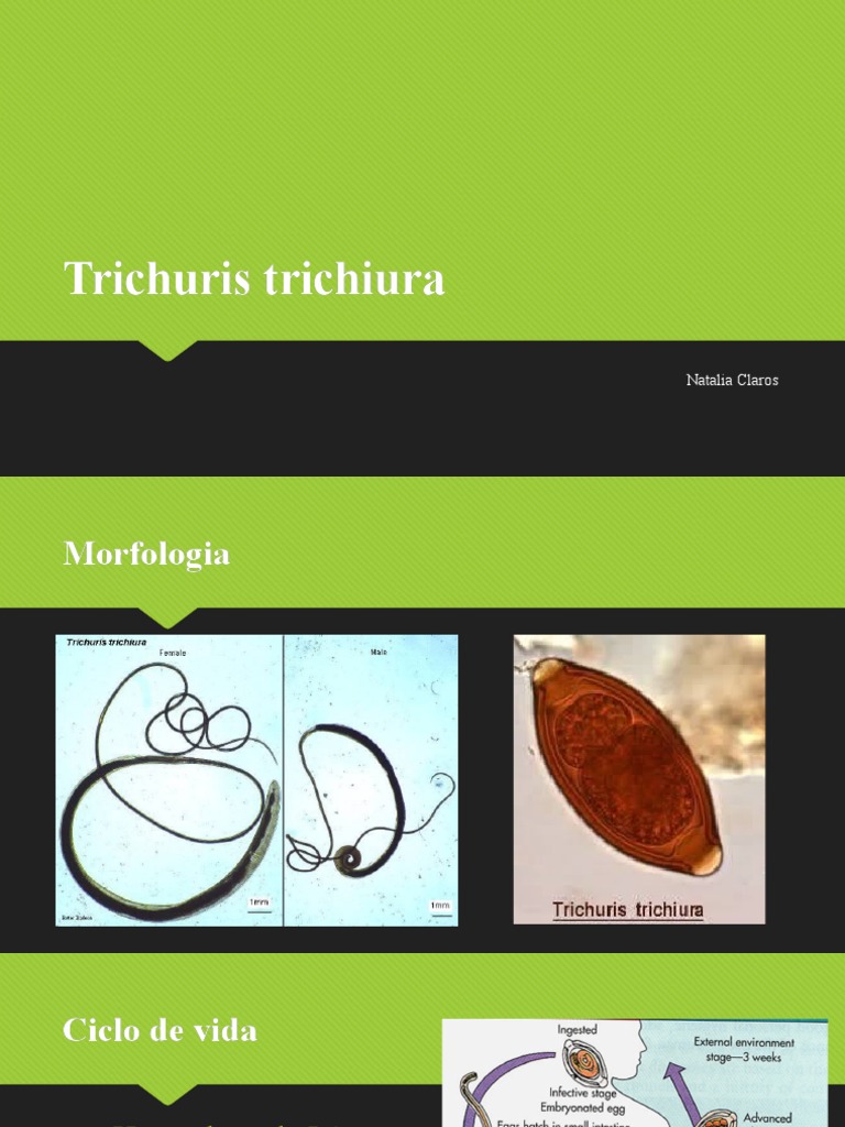 3.trichuris Trichiura | PDF