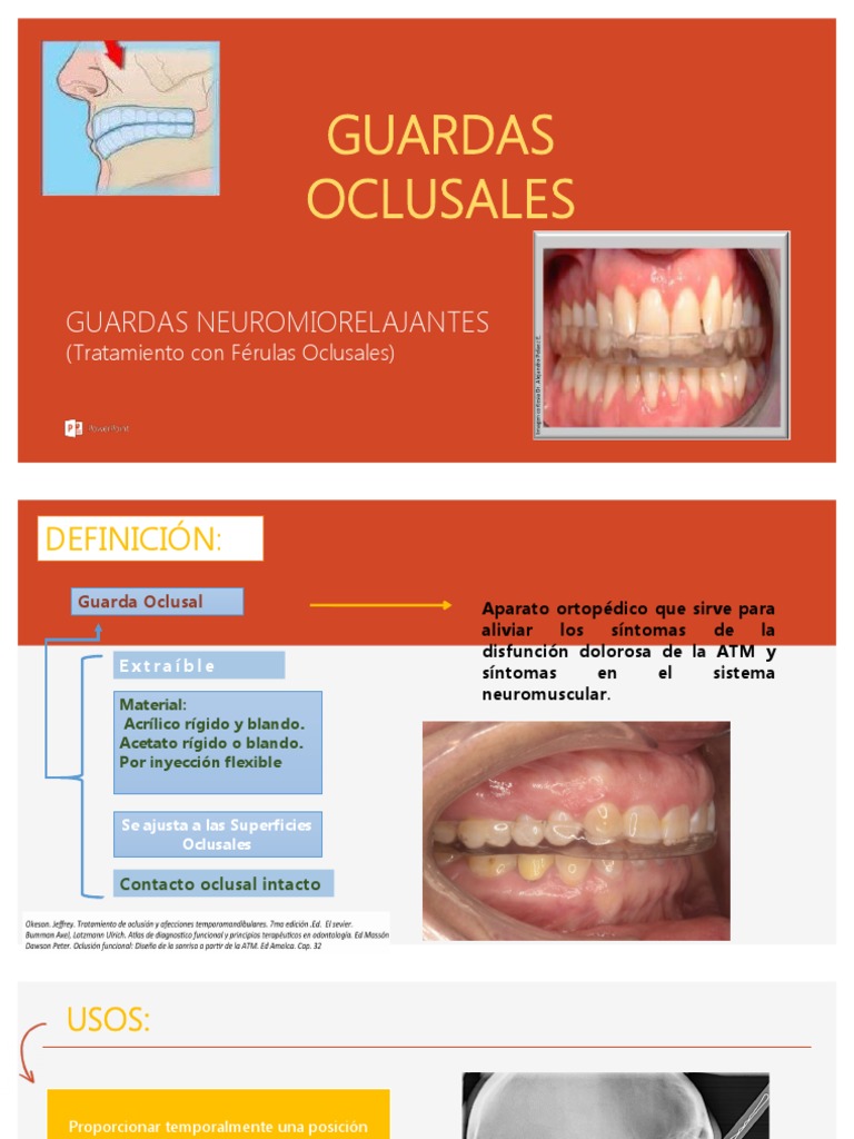 Tipos y Usos de Guardas Oclusales | PDF | Odontología | Diente