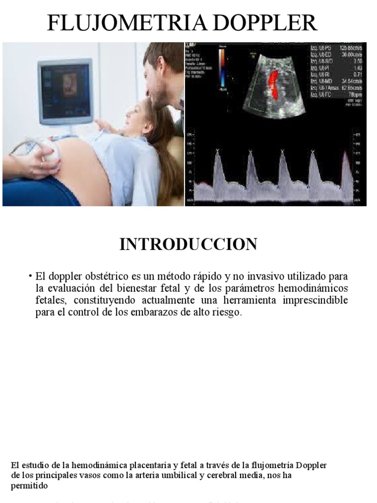 Flujometria Doppler | PDF | Feto | Artería