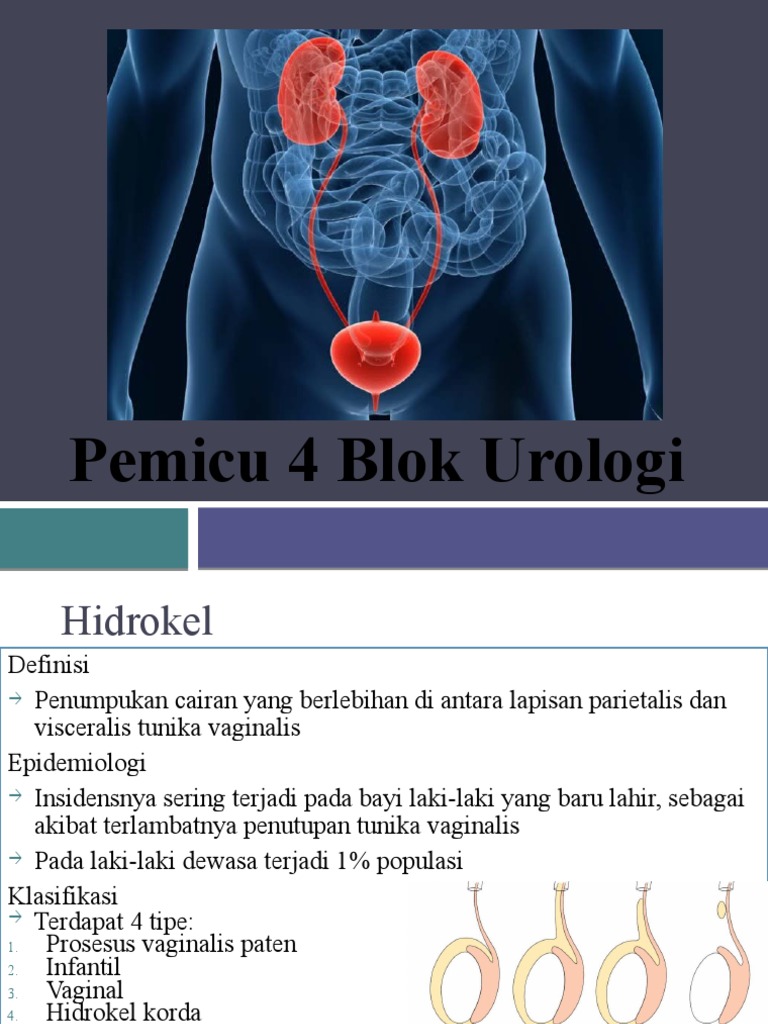 Hidrokel: Definisi, Diagnosis, dan Tatalaksana | PDF