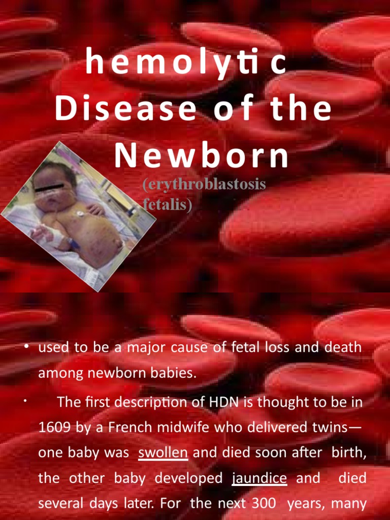 Erythroblastosis Fetalis Overview | PDF | Health Sciences | Hematology
