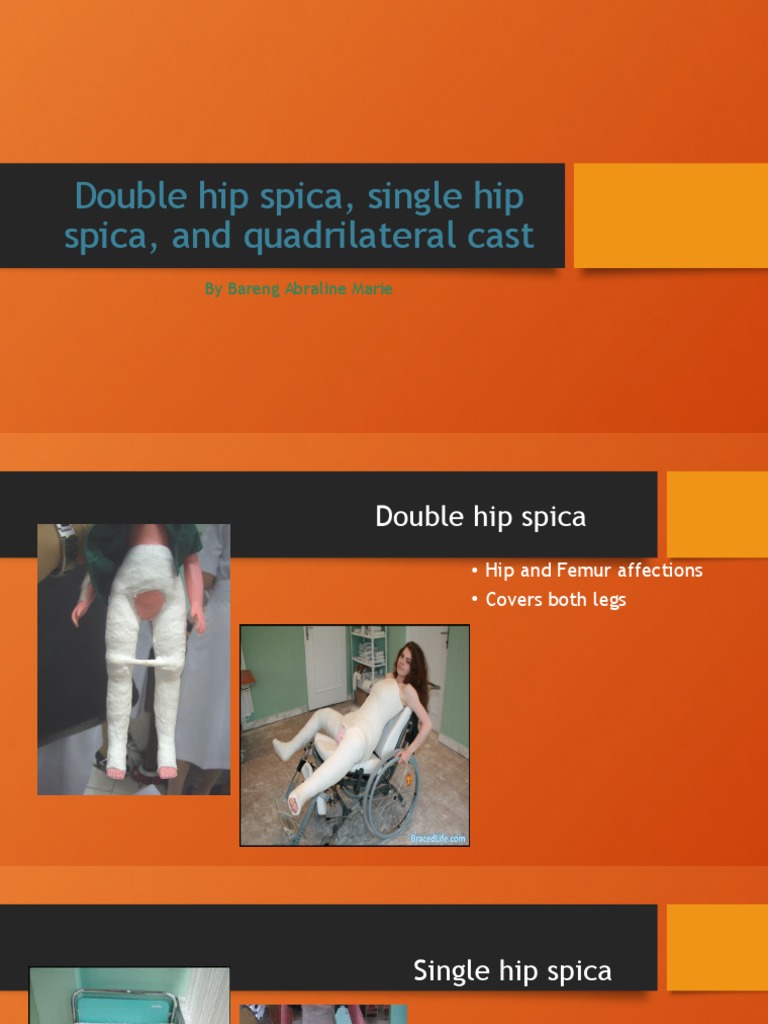 Double Hip Spica, Single Hip Spica, and Quadrilateral Cast: by Bareng ...