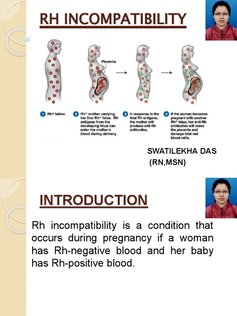 RH Incompatibility: Swatilekha Das (RN, MSN) | PDF | Hematology ...